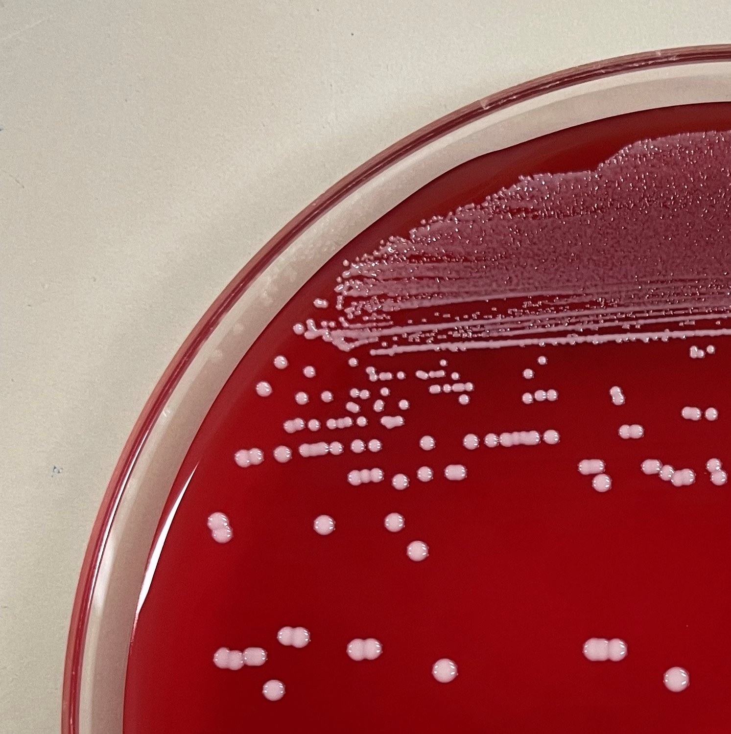 細菌検査 | 臨床検査部 | 各種部門 | 診療科・部門 | 【公式】医療法人川崎病院